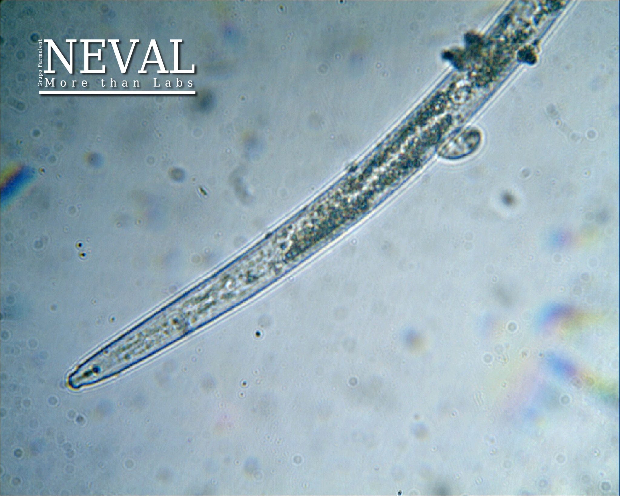 Umbrales de Nematodos fitoparásitos en Céspedes deportivos - NEVAL ...