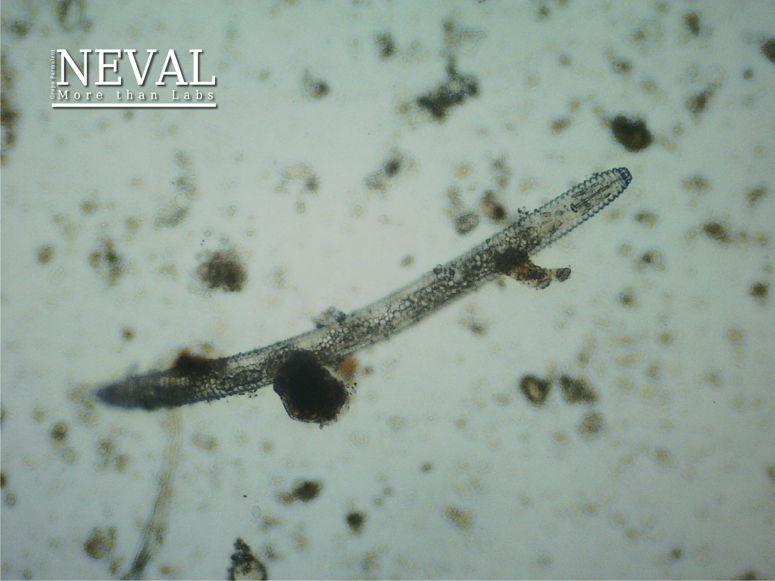 Umbrales de Nematodos fitoparásitos en Céspedes deportivos - NEVAL ...