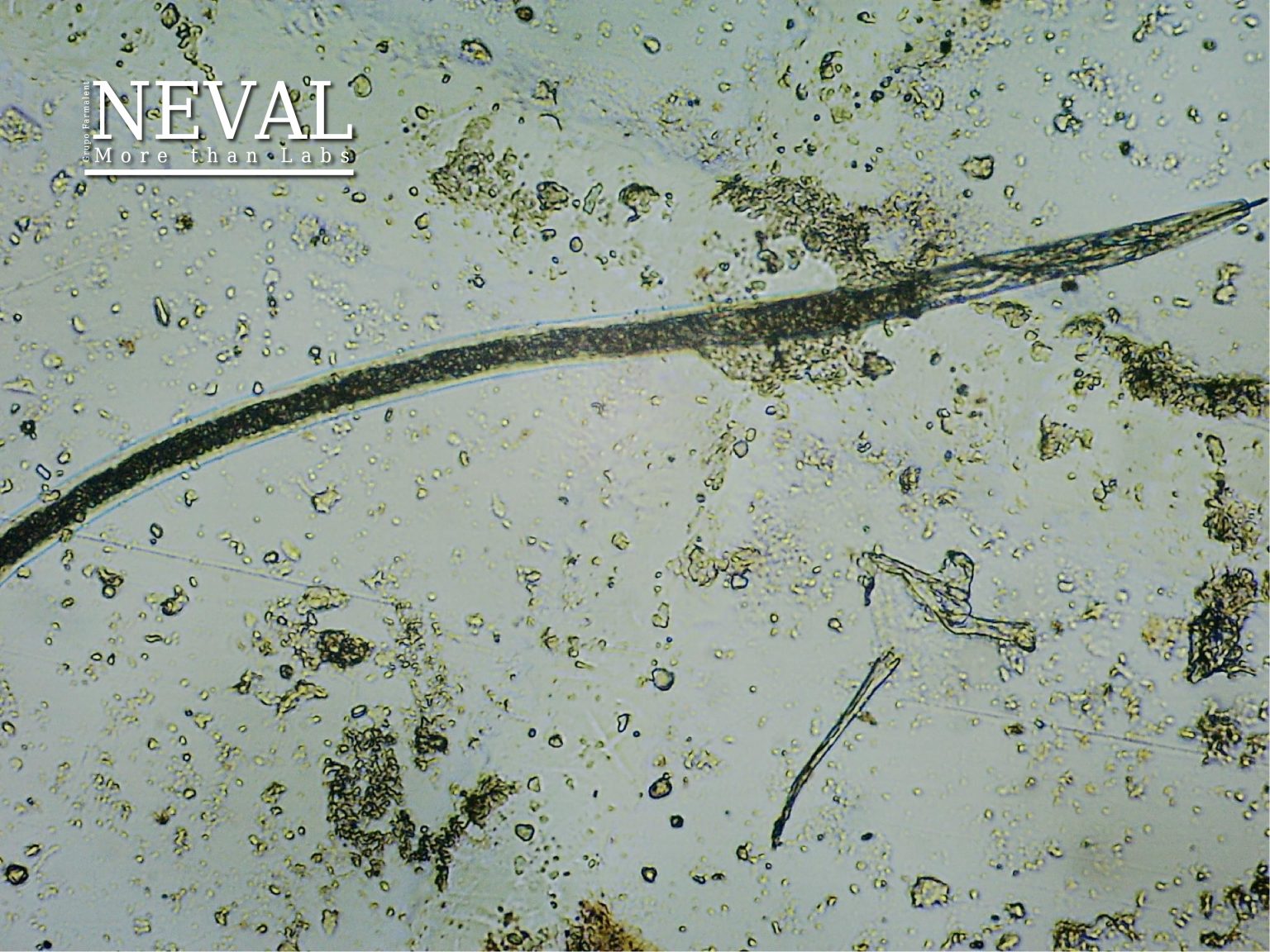 Umbrales de Nematodos fitoparásitos en Céspedes deportivos - NEVAL ...